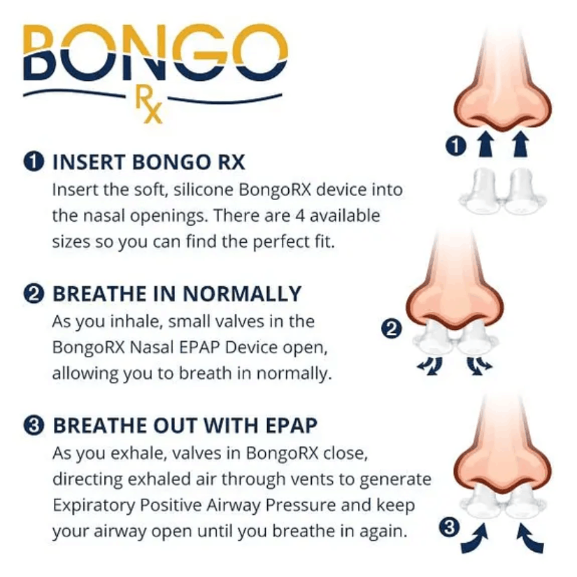 Bongo RX Starter Kit EPAP Device | CPAPsupplies.com