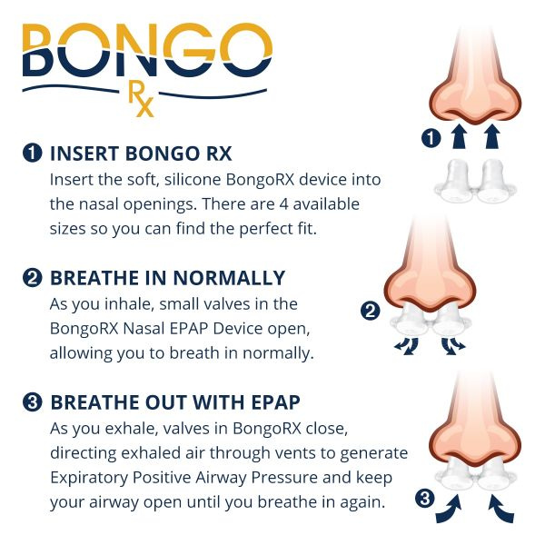 Bongo RX Starter Kit EPAP Device | CPAPsupplies.com